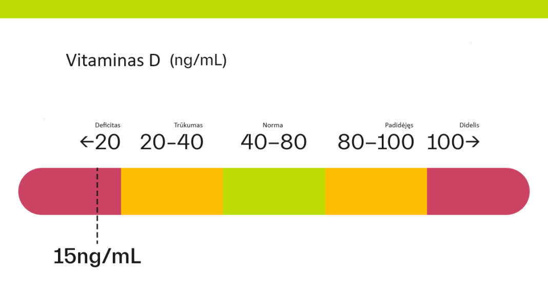 Vitamino D norma (lentelė): Trūkumo simptomai ir perdozavimas | Faktograma